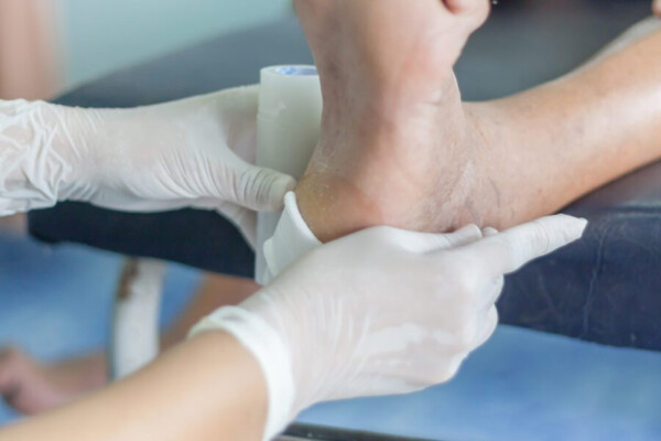 Best Diabetic Wound Care Products – Cincinnati Foot & Ankle Care
